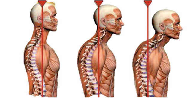 Tingling hands, tight muscles and bad posture – the untold story of ...